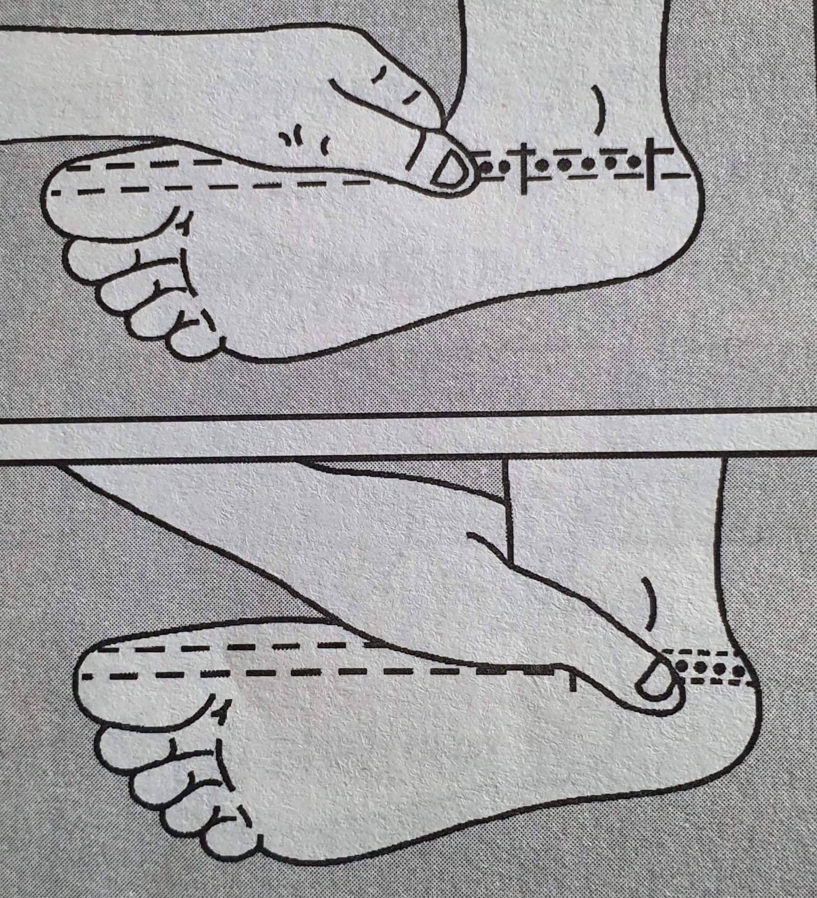 Top 10 Acupressure points for Sciatica Pain Relief at Home