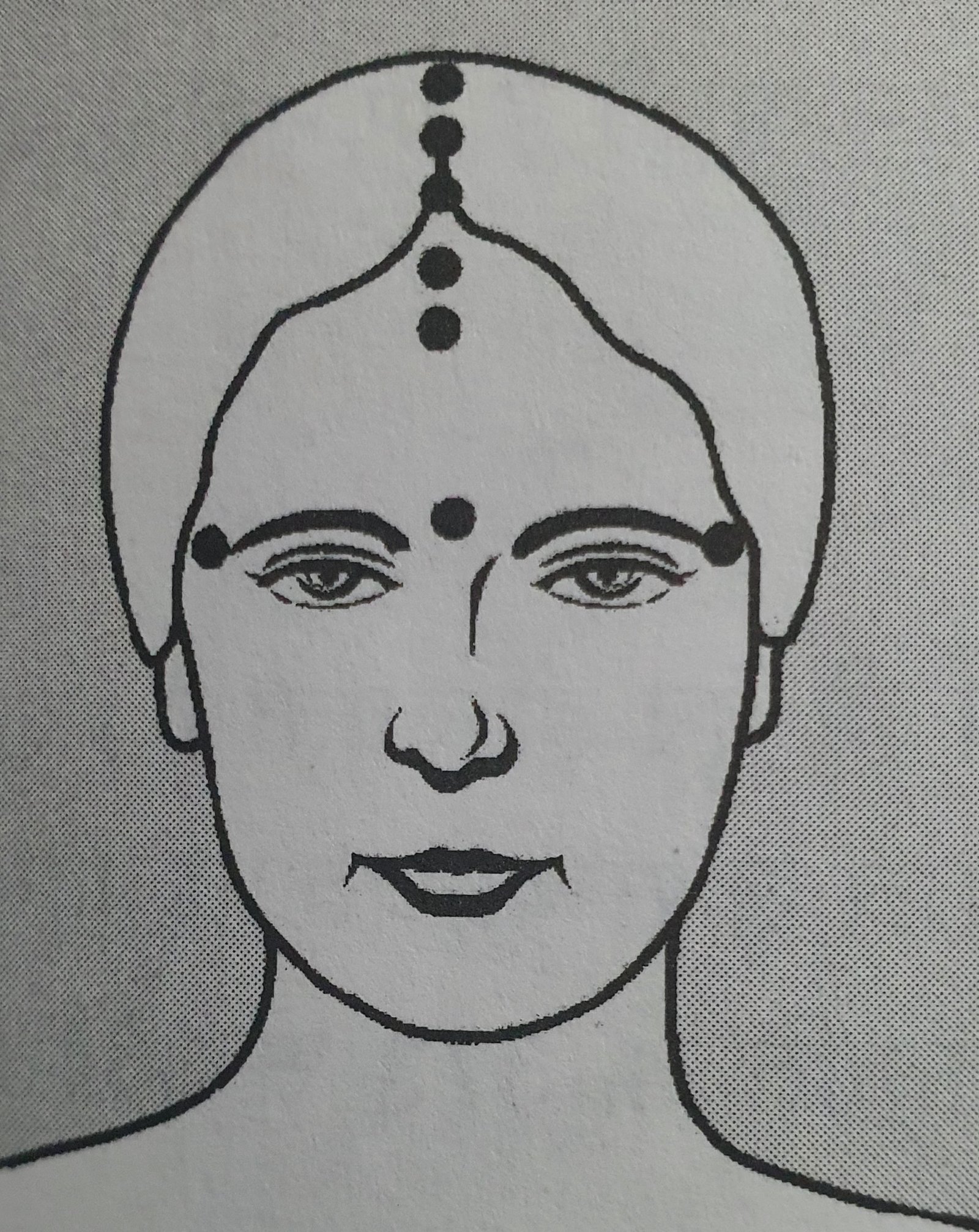 Acupressure treatment of Headaches & Migraine-Vacu Care Center