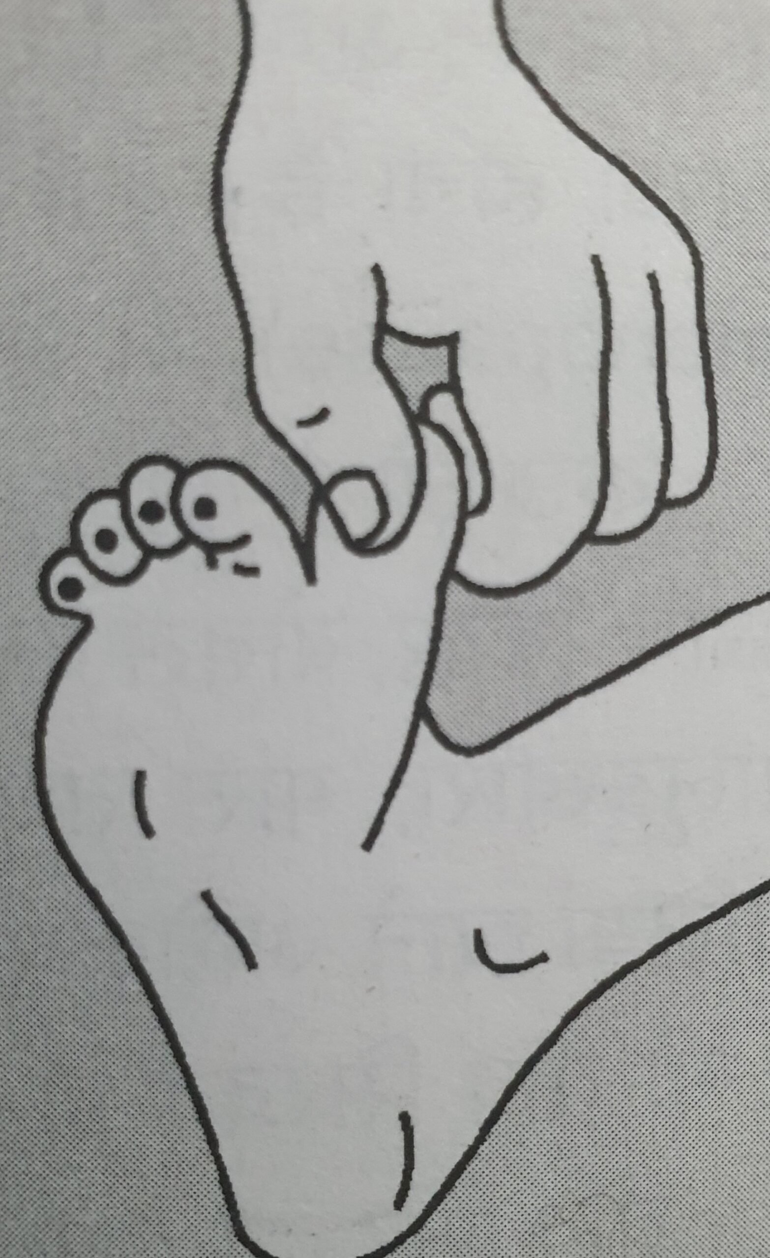 Acupressure treatment of Headaches & Migraine-Vacu Care Center